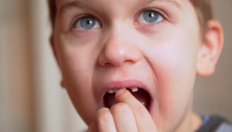 What Do Dreams About Teeth Falling Out Mean? A Comprehensive Breakdown